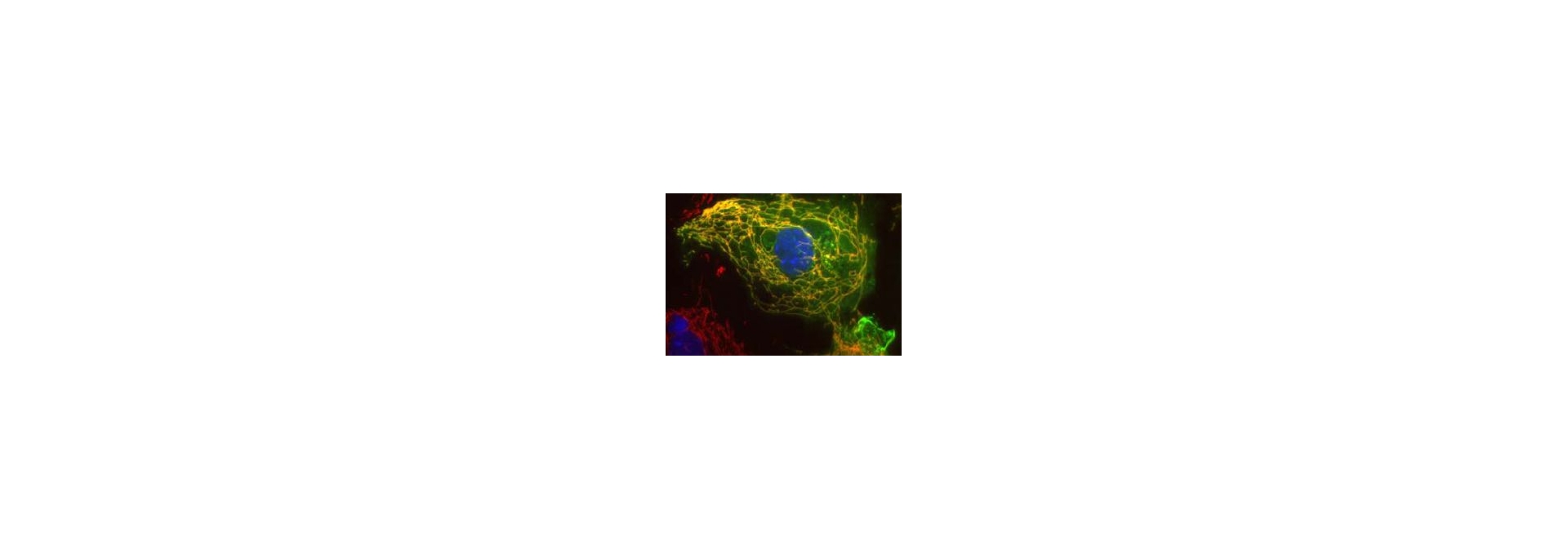Protein Regulates Movement of Mitochondria in Brain Cells | University ...