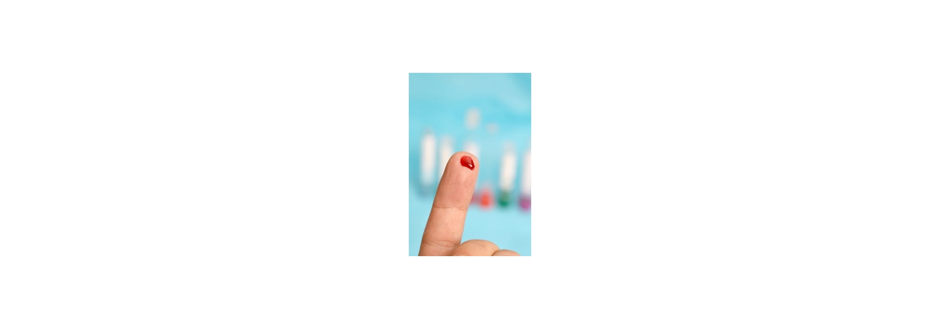 Blood Test for Brain Injury Faces Hurdles | University of Rochester ...