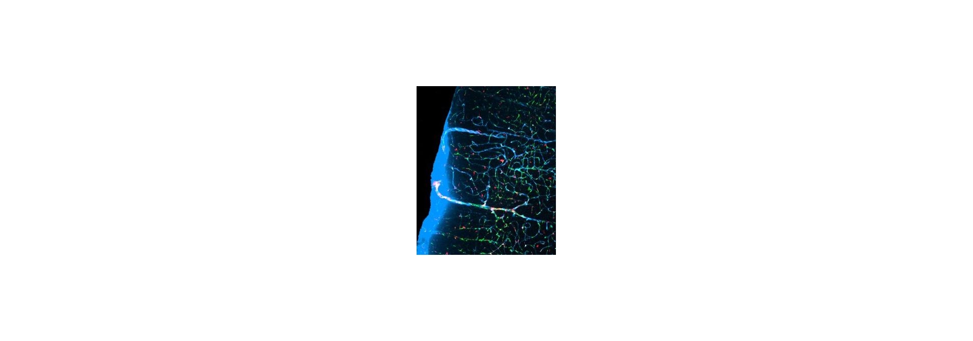 URMC Study Chosen as One of the “Breakthroughs of the Year ...