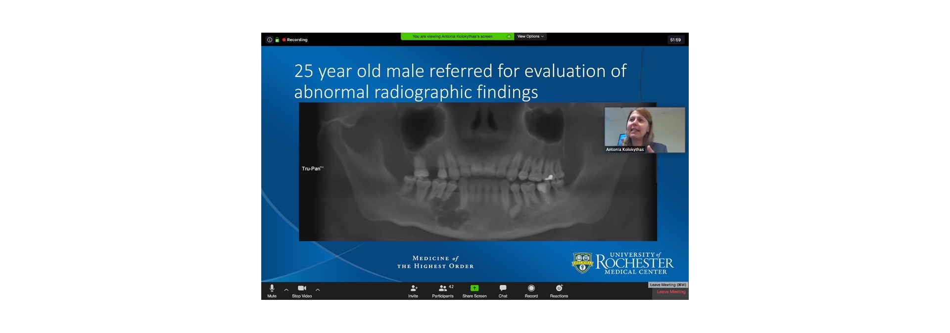 OMFS International Grand Rounds a First at URMC | University of ...