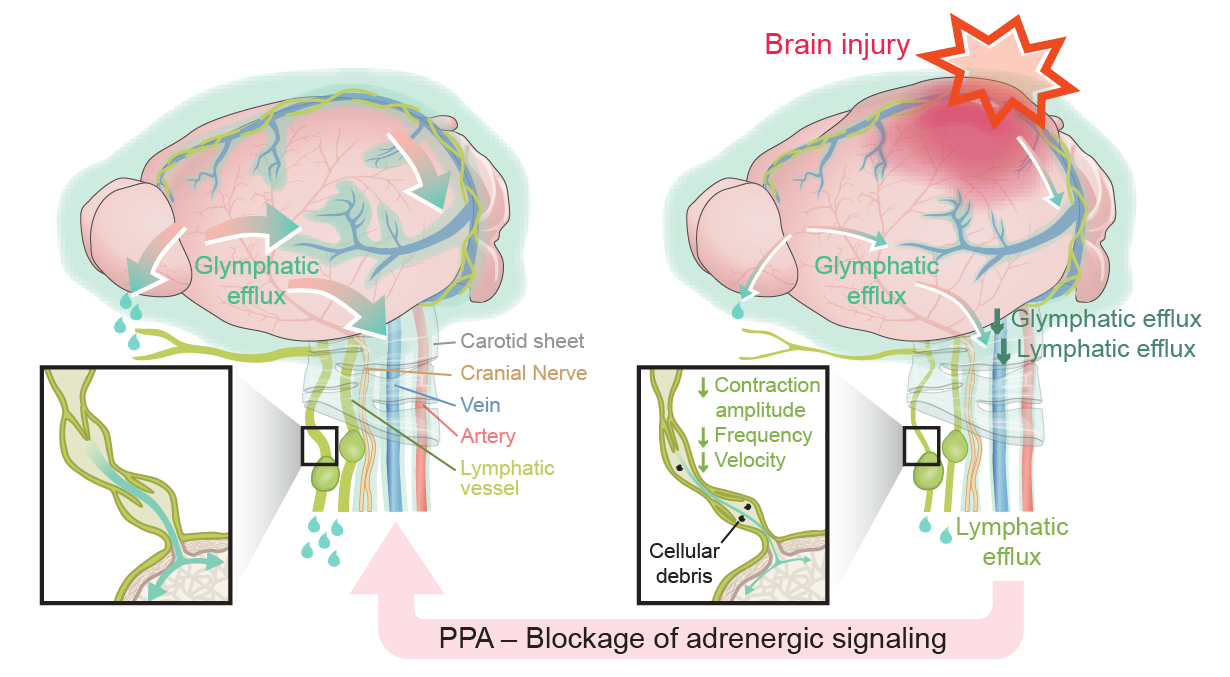 Manipulating Fluid Flows in the Brain Could Save Lives, Improve ...