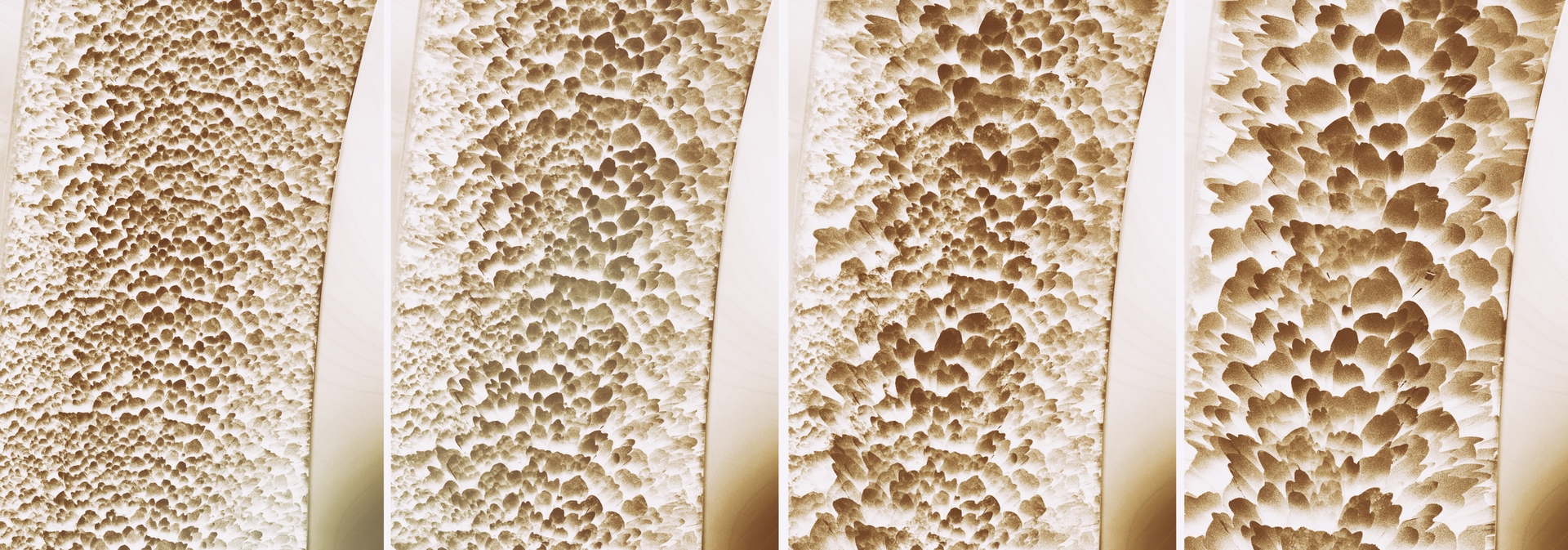 UR Scientists Working to Crack Enduring Mystery of Bone Loss ...