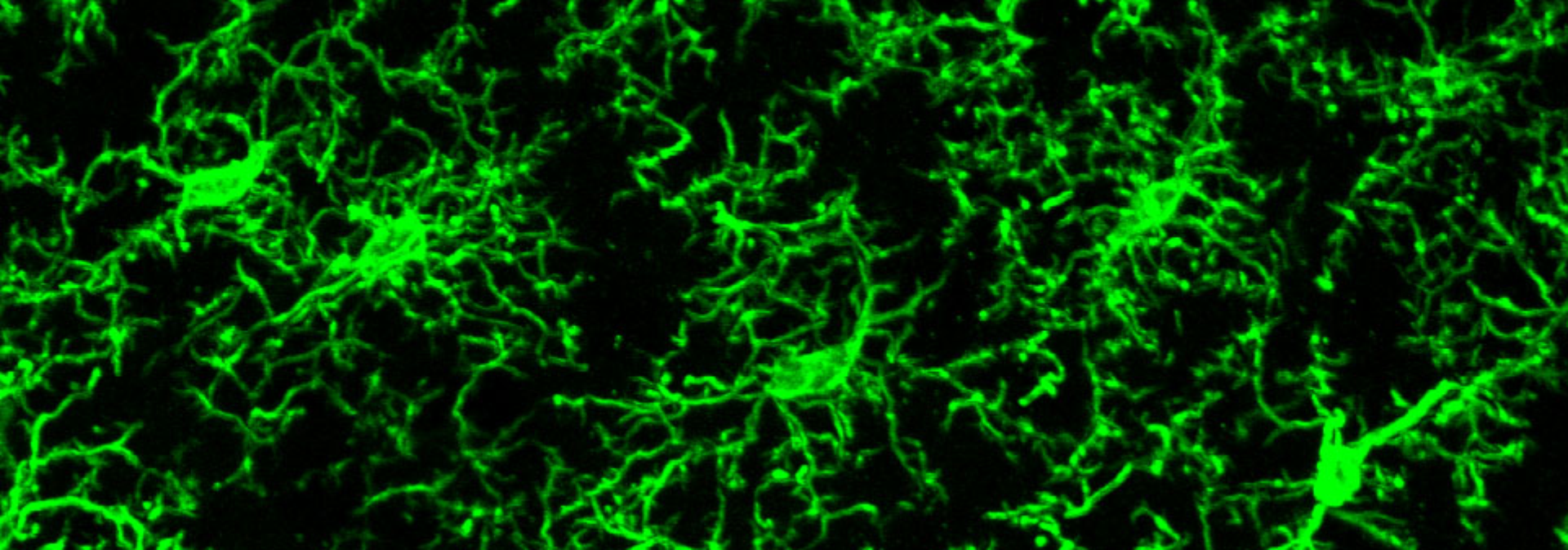 Brain Immune Cells May also be From Mars and Venus | URMC Newsroom