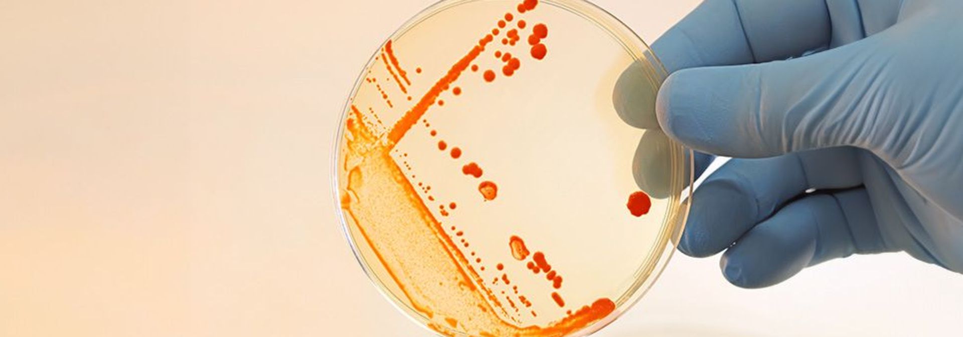 Can Men Have Bacterial Vaginosis? | URMC Newsroom