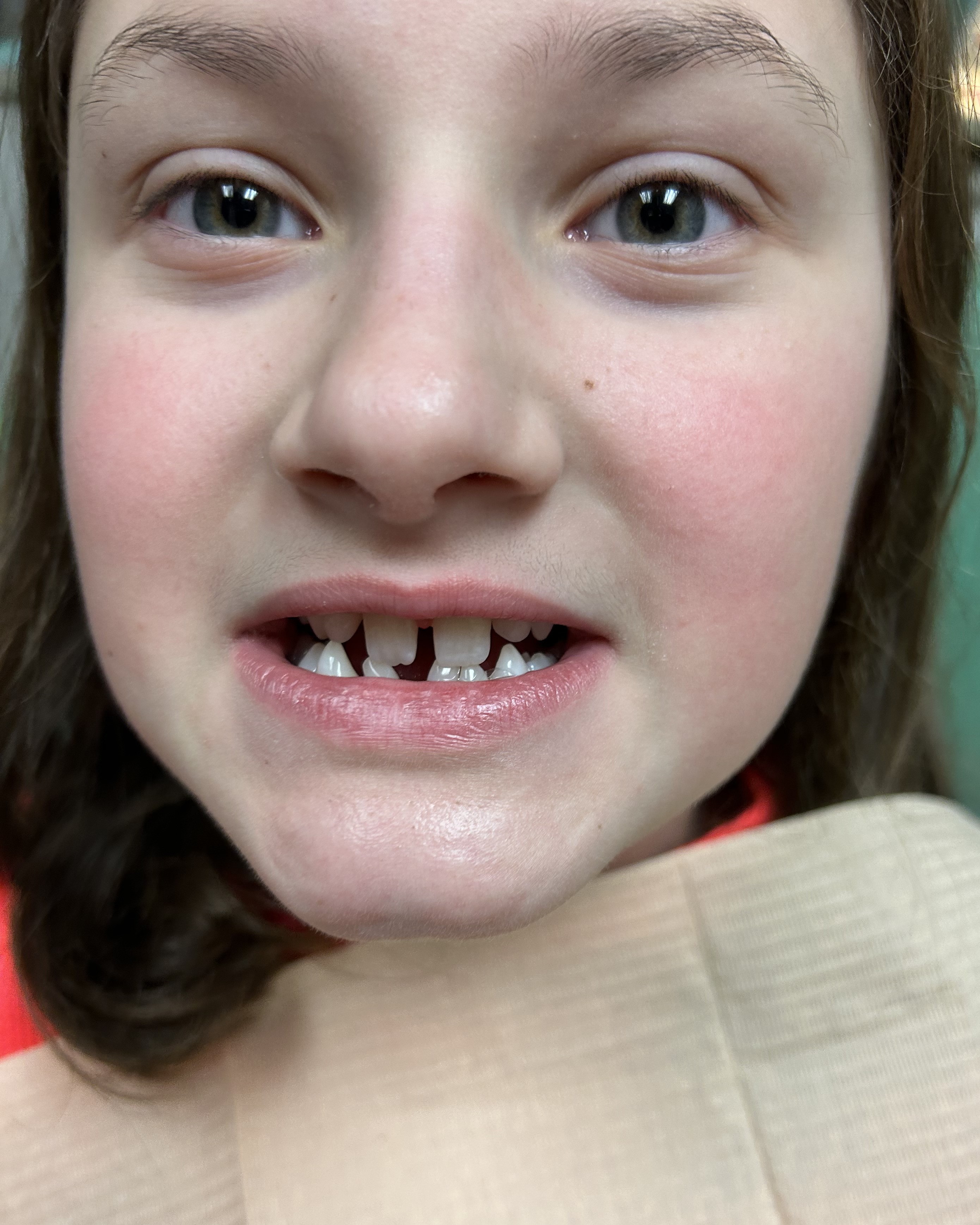 Journey to Confidence: Restoring a Smile and Changing a Life | URMC ...