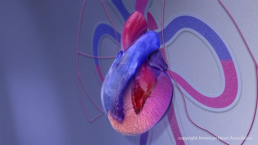 Heart Association Animations | American Heart Association