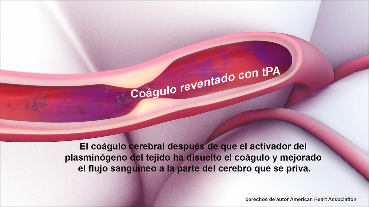 AHA/ASA Medical Graphics and Illustrations | American Heart Association